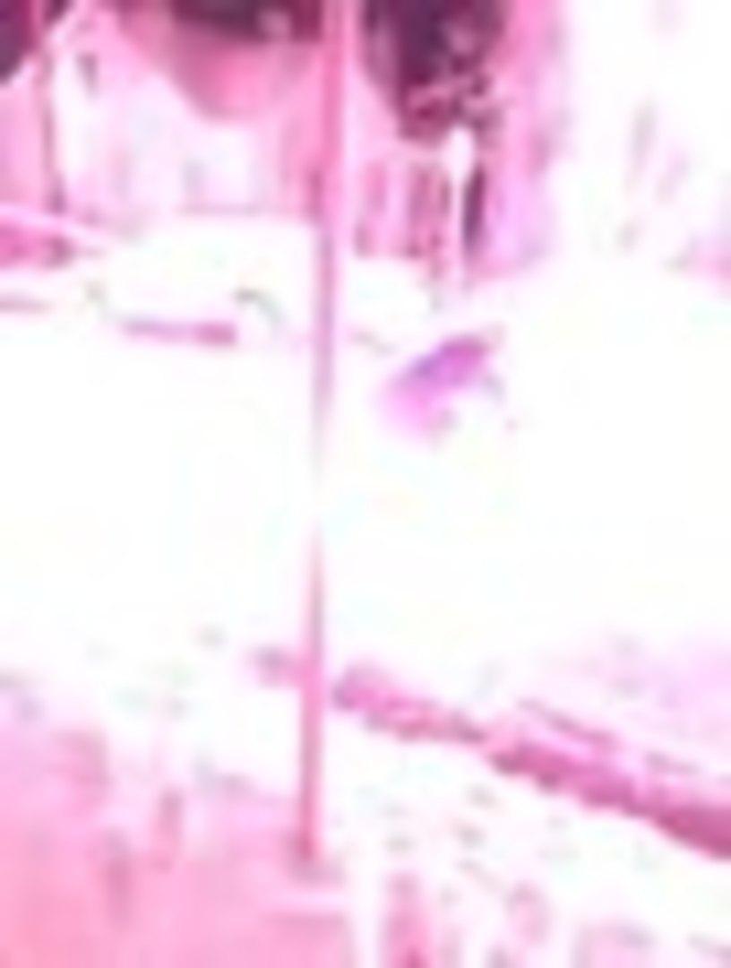 Guy Almost Loses Leg from Fireworks Explosion | Jukin Licensing