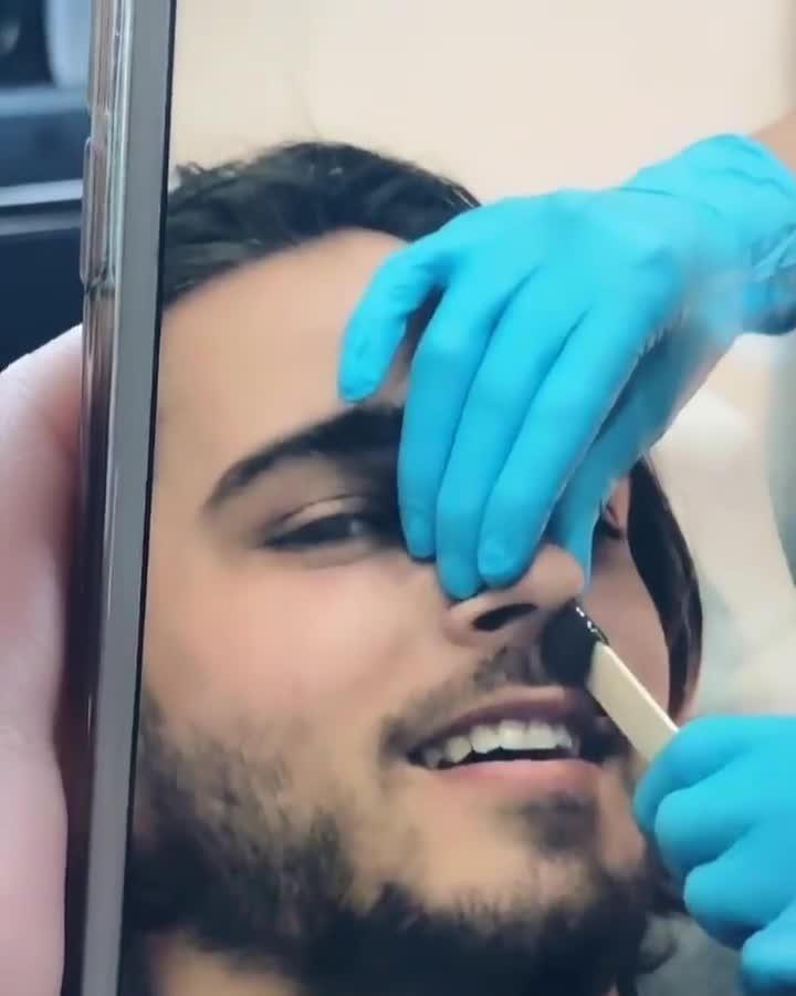 Guy Narrates Story of Accidentally Getting Mustache Ripped Off While ...