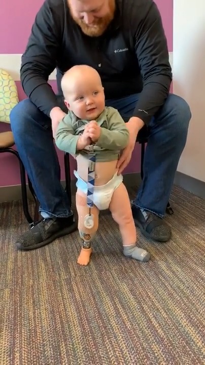 Boy Born Without Leg Dancing for First Time | Jukin Licensing