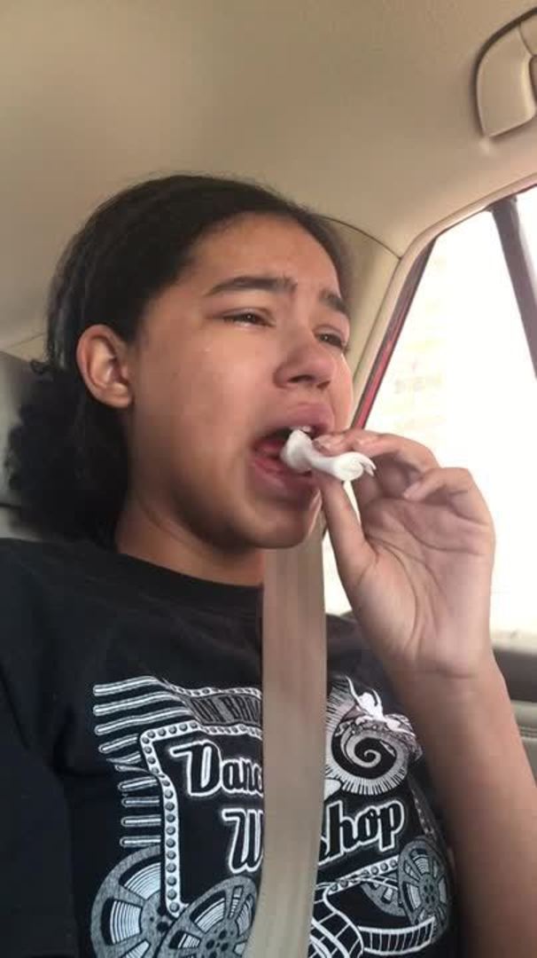 Girl Thinks Tongue Falls Out After Wisdom Tooth Removal | Jukin Licensing