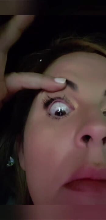 Girl Pulls Big Chunks Of Eyelashes And Creates Bald Spot On Lashline ...